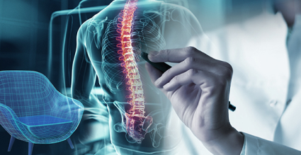 코웨이 BEREX | coway